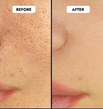 Vitamin B3 Serum - Niacinamide Serum For Face Online | CosIQ